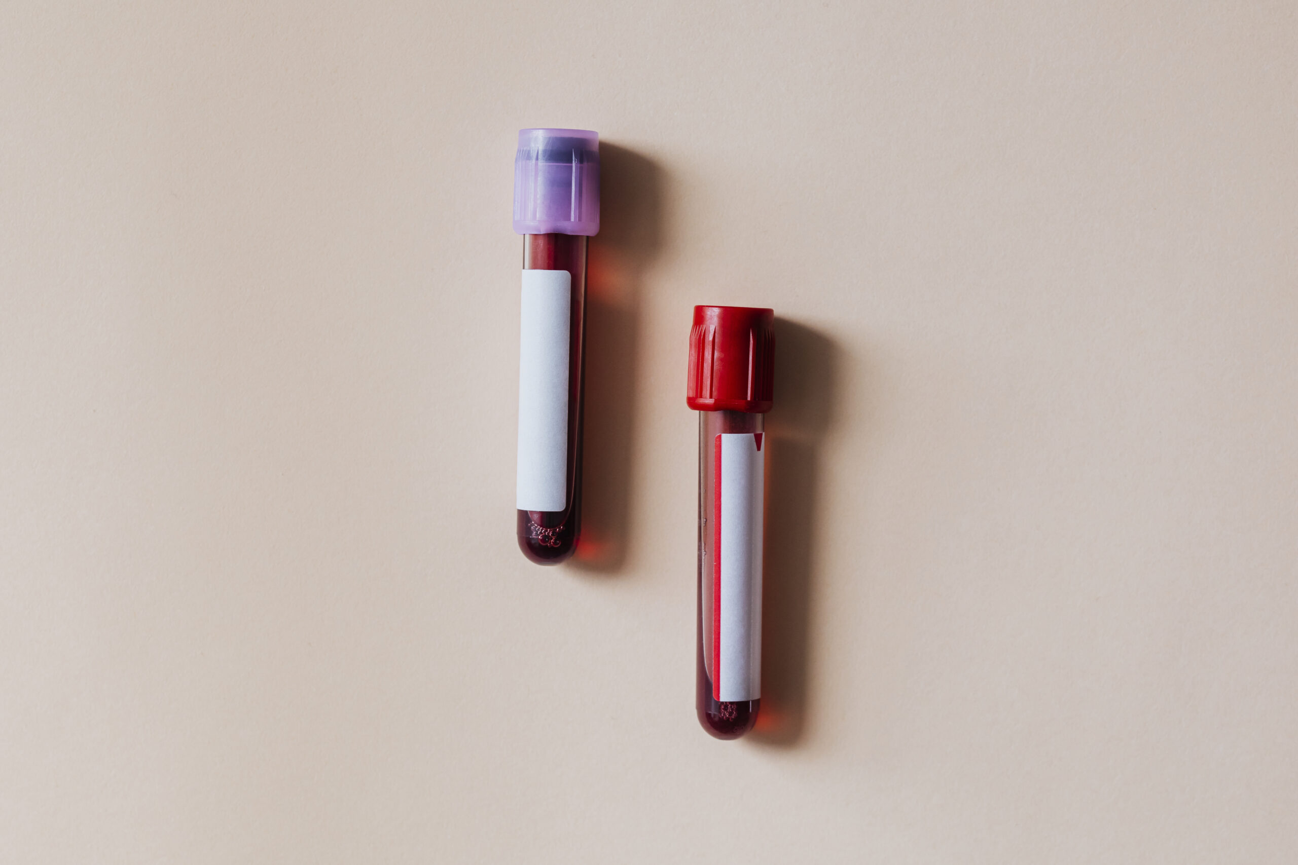 Un test de sânge detectează 50 de tipuri de cancer înainte să apară ...